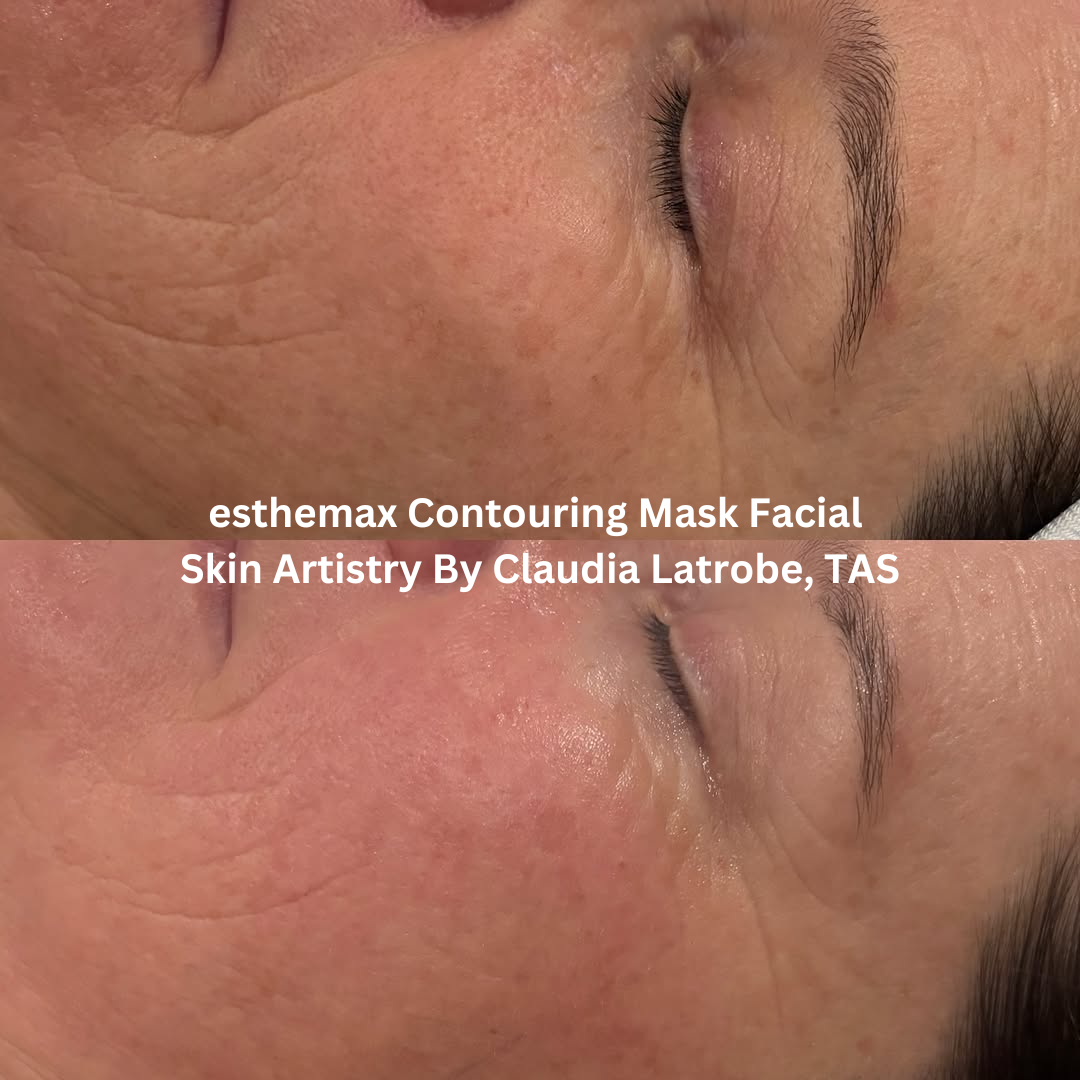 Client Transformation – Esthemax Australia